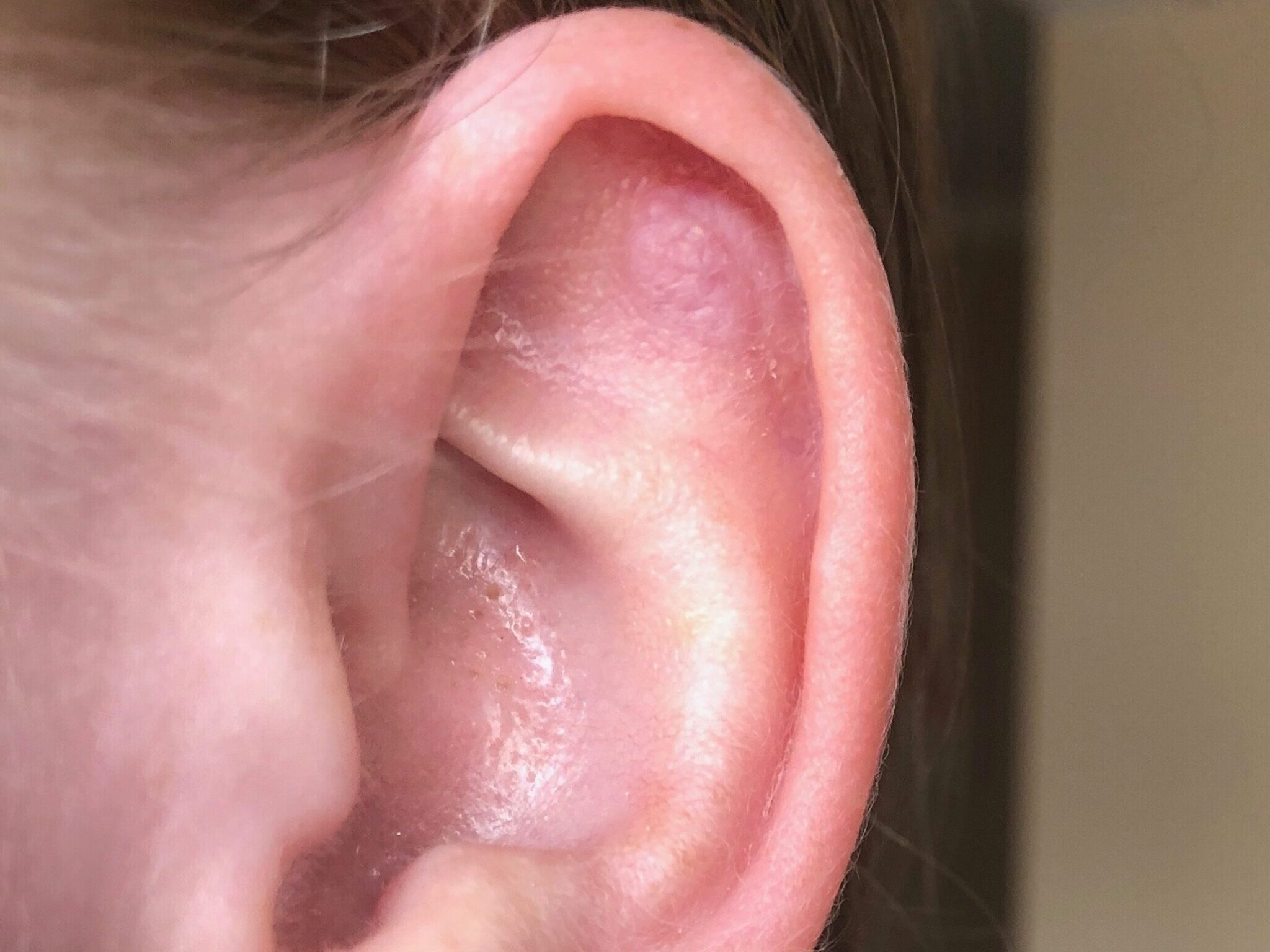 Panorama Dermatology Clinic - Panorama Wellness Centre